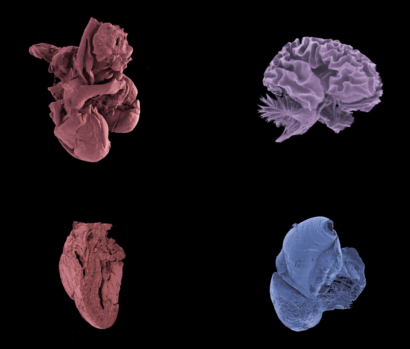 Lancement du Human Organ Atlas : un portail 3D pour explorer les ...